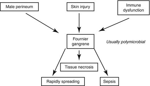 Fournier Gangrene | SpringerLink