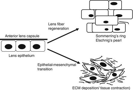 Wound Healing and Epithelial–Mesenchymal Transition in the Lens ...