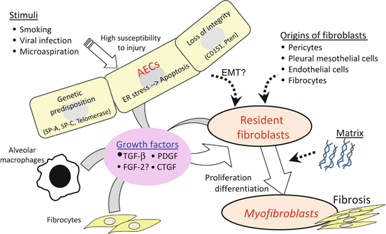 Pathogenesis of IPF | SpringerLink