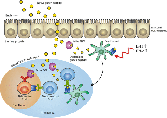 Transglutaminase 2 and Celiac Disease | SpringerLink