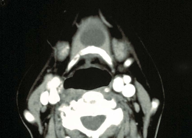 Afwijkingen van de hals | SpringerLink