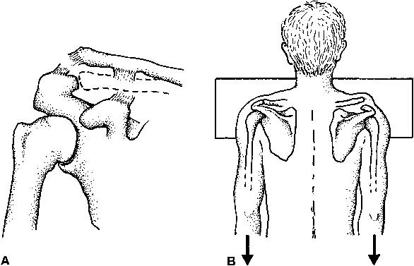 19 Letsels van het bewegingsapparaat | SpringerLink