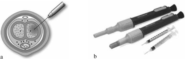 Dwarslaesie | SpringerLink