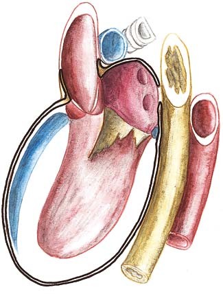 19 Het pericard | SpringerLink