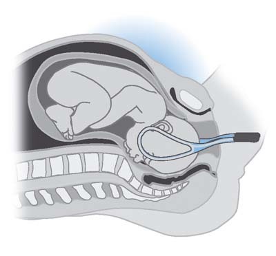 10 Het uitvoeren van abdominale en gynaecologische handelingen ...