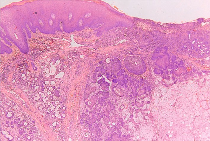Het gehemelte | SpringerLink