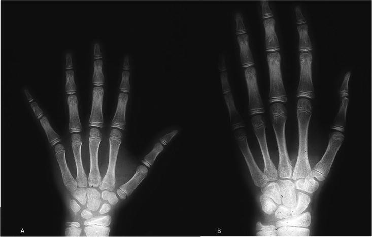 Lichamelijke ontwikkeling van jongeren | SpringerLink