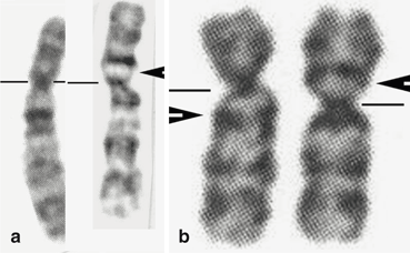 Chromosome 10 | SpringerLink