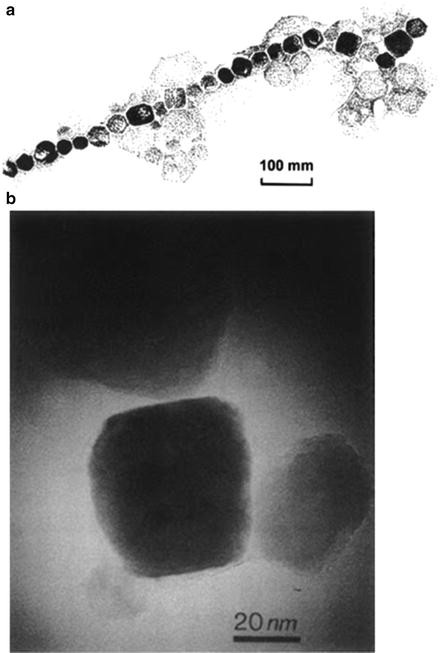 Magnetite Minerals in the Human Brain: What Is Their Role? | SpringerLink