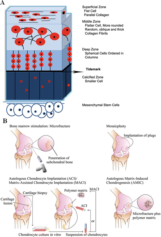 Cartilage Regeneration | SpringerLink
