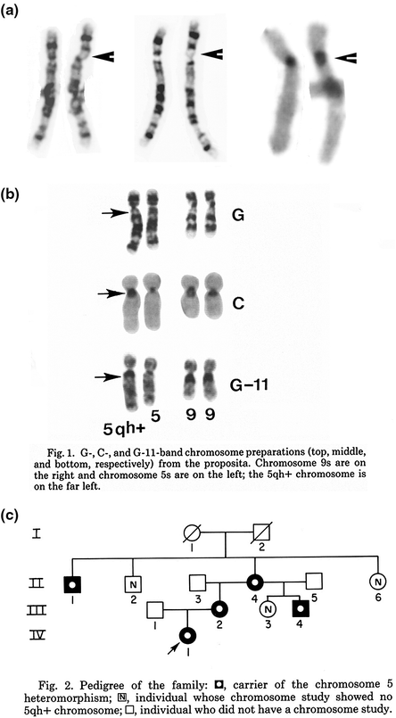 Chromosome Heteromorphism (Summaries) | SpringerLink