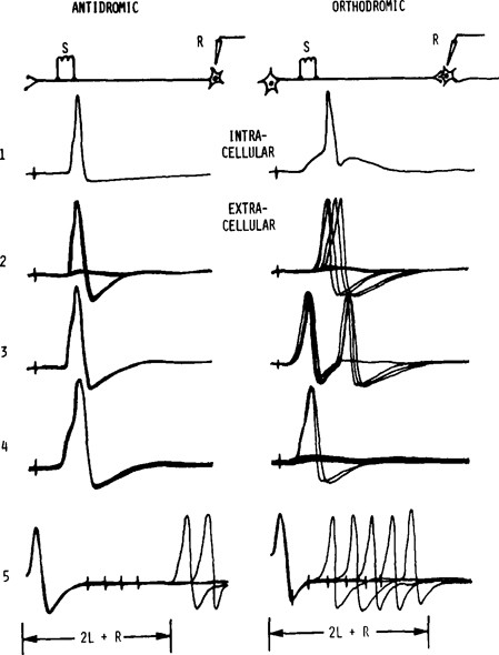 Extracellular Single-Unit Recording Methods | SpringerLink