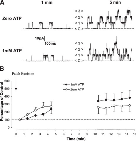 Single-Channel Recording | SpringerLink