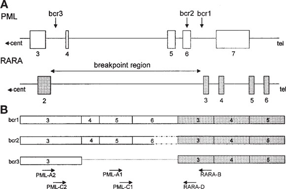 Diagnosis and Monitoring of PML-RARA-Positive Acute Promyelocytic ...