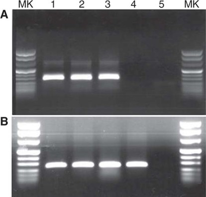 Diagnosis and Monitoring of PML-RARA-Positive Acute Promyelocytic ...