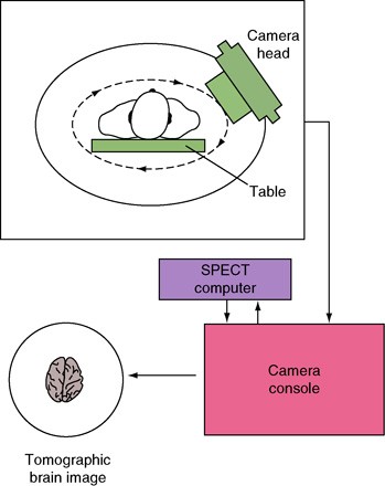 SPECT Imaging | SpringerLink
