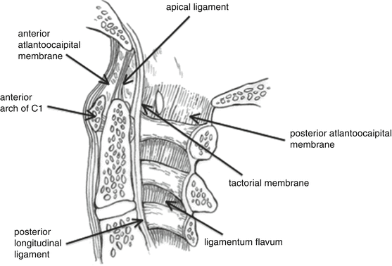Craniocervical Junction, Abnormalities | SpringerLink