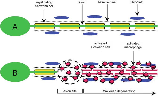 Wallerian Degeneration | SpringerLink