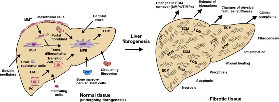 Experimental liver fibrosis research: update on animal models, legal ...
