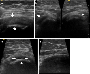The role of ultrasound in the assessment of post-operative ...