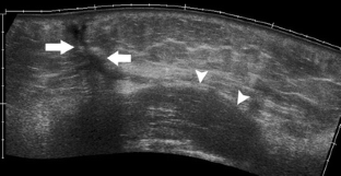 The role of ultrasound in the assessment of post-operative ...