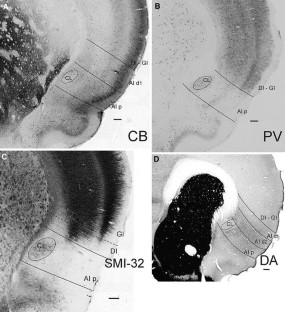 The rat orbital and agranular insular prefrontal cortical areas: a ...