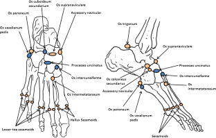 Accessory ossicles of the foot—an imaging conundrum | SpringerLink