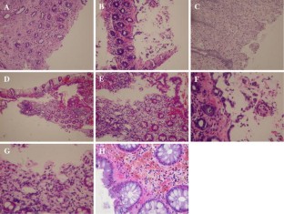Endoscopic Findings and Clinicopathologic Characteristics of Ischemic ...