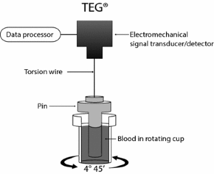 Review of Thromboelastography in Neurocritical Care | SpringerLink