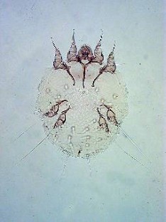 Milben als Zoonoseerreger des Menschen | SpringerLink