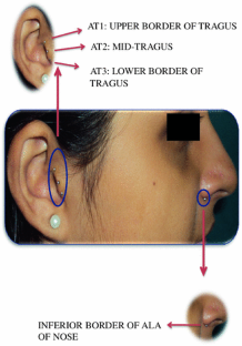 A Cephalometric Study on the Relationship Between the Occlusal Plane ...