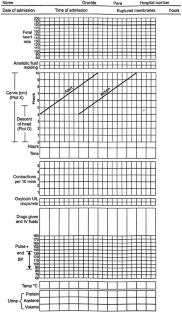 The Partograph in Childbirth: An Absolute Essentiality or a Mere ...