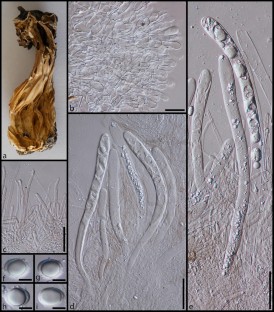 Taxonomy and phylogeny of operculate discomycetes: Pezizomycetes ...