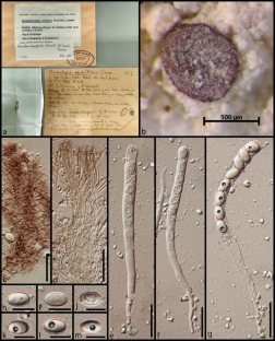 Taxonomy and phylogeny of operculate discomycetes: Pezizomycetes ...