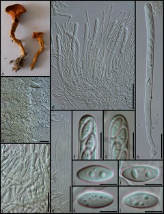 Taxonomy and phylogeny of operculate discomycetes: Pezizomycetes ...