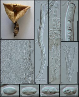 Taxonomy and phylogeny of operculate discomycetes: Pezizomycetes ...