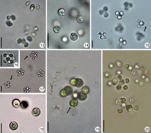 Planktonic Radiococcaceae Fott ex Komárek of the Tigres Lake system ...