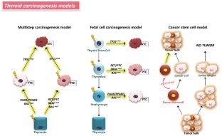 Normal vs cancer thyroid stem cells: the road to transformation | Oncogene