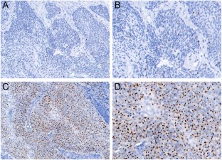HPV RNA CISH score identifies two prognostic groups in a p16 positive ...
