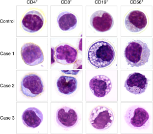 B-cell-specific accumulation of inclusion bodies loaded with HLA class ...