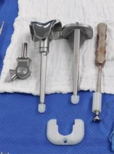 Revision arthroplasty with rotating hinge systems for total knee ...