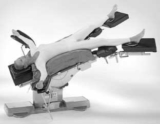 Lagerung des Patienten zur Operation | SpringerLink