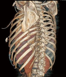 Ultraschallgestützte thorakale Paravertebralblockade beim akuten Thoraxtrauma | SpringerLink