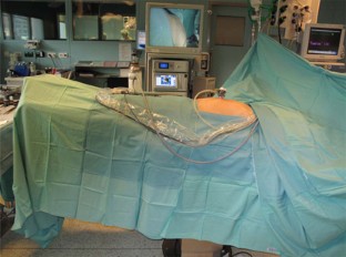 Laparoskopische Appendektomie | SpringerLink