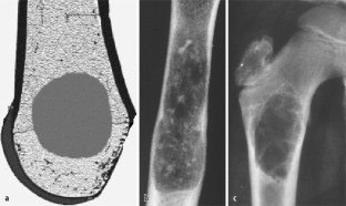 Basisdiagnostik von Knochentumoren | Die Radiologie