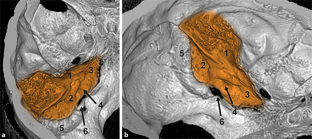 Anatomie des Felsenbeins | SpringerLink