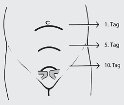 Das Wochenbett | SpringerLink