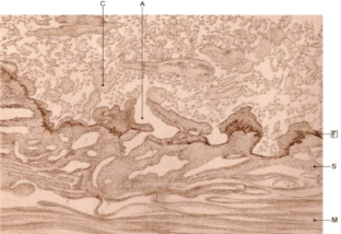 Raissa Nitabuch und die Nachgeburt | SpringerLink