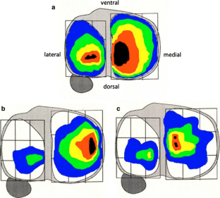 The basic science of the subchondral bone | SpringerLink