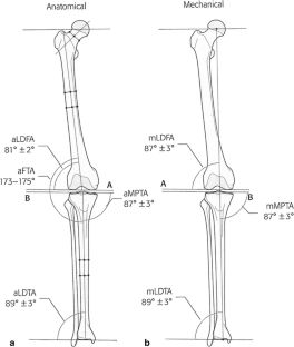 Osteotomy around the knee: evolution, principles and results | SpringerLink
